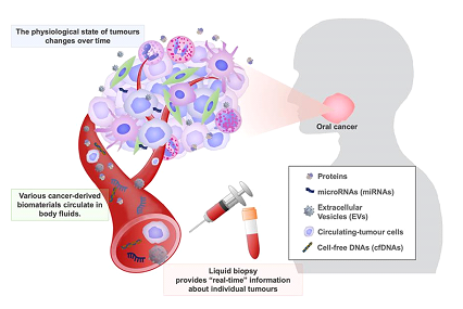 Early Cancer Detection through Bioliquids, Biosensors, and AI - GENÇOMÜ